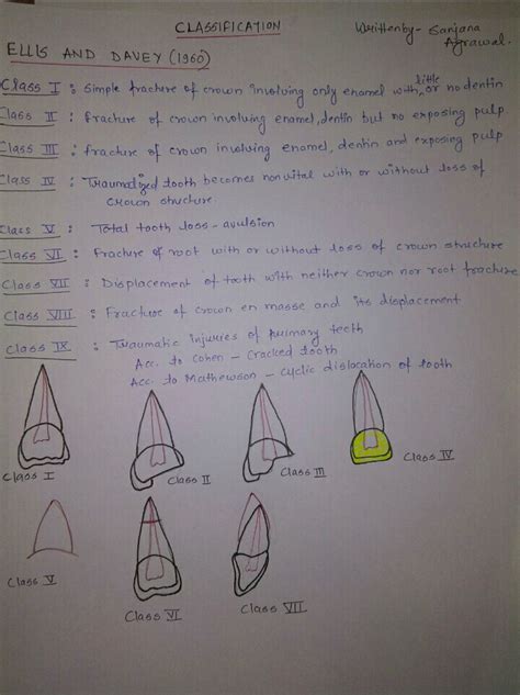 Traumatic Injuries Ellis And Daveys Classification Dentowesome Traumatic Injuries Ellis And Daveys Classification Dentowesome