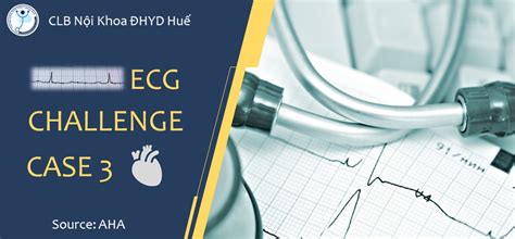 Ecg Challenge Imc