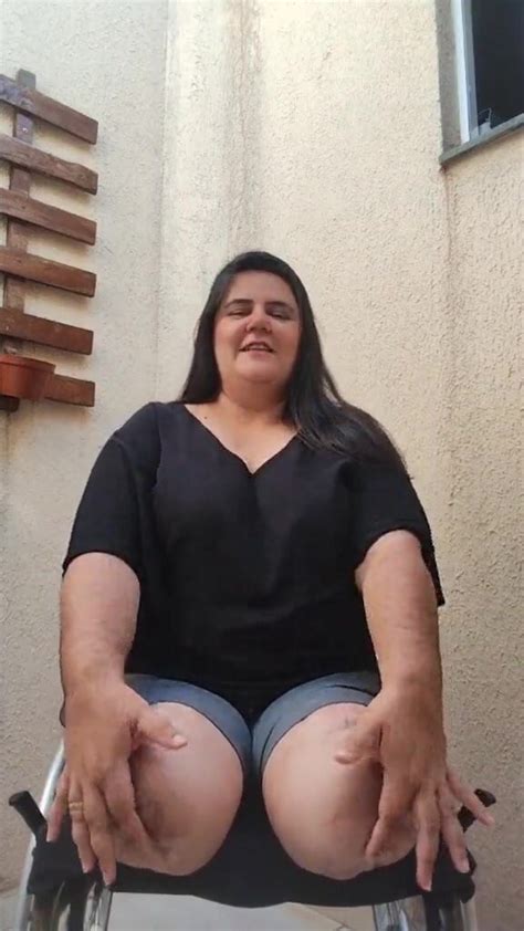 Beautiful Leg Stumps Thisvid Com