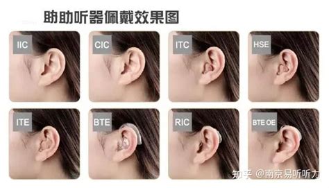 选配助听器前，你需要了解哪些知识？ 知乎