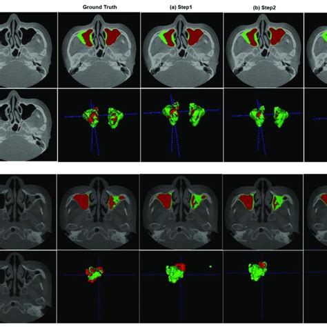 Best First Rows And Worst Second Rows From The Test Dataset