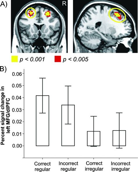 Neural Correlates Of Grammatical Inflection In Older Native And Second