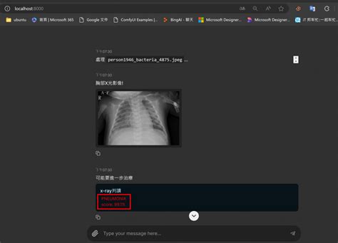 🎥胸部x光影像模組化 Youtube生成部落格及總結轉成網頁 自創ai傳送line Ai解釋簡報 圖片去背 Ai Sql Ai多醫療模型