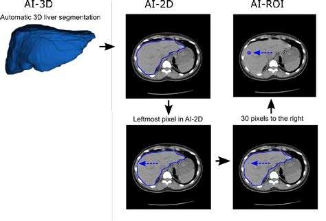 Fully Automated Deep Learning Enabled Detection For Hepatic Steatosis