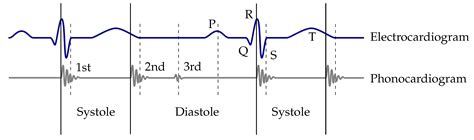 Phonocardiogram Microphone Clipart