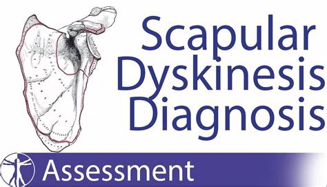 Diagnosing Scapular Dyskinesis Diagnosing Scapular Dyskinesis The Literature Describes 3