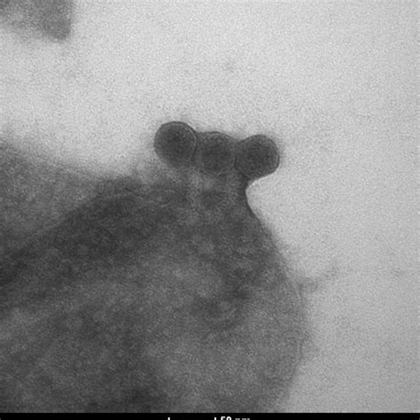 Transmission Electron Micrographs Of Reactivated Prophages Of Download Scientific Diagram