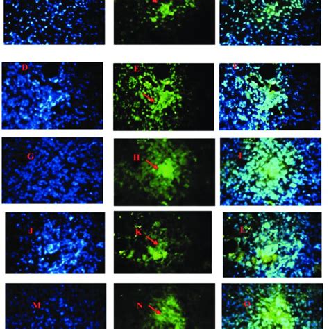 Immunohistochemical Analysis Of Hif 1α Expression Representative