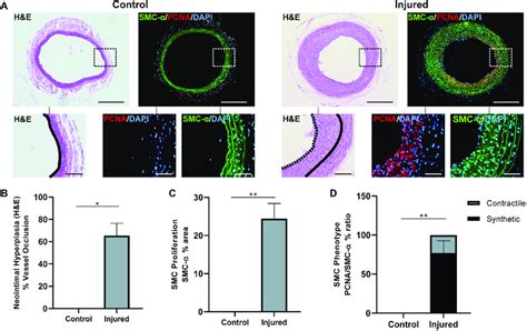 Activation Of Vascular Inflammation At 2 Weeks Post Injury A