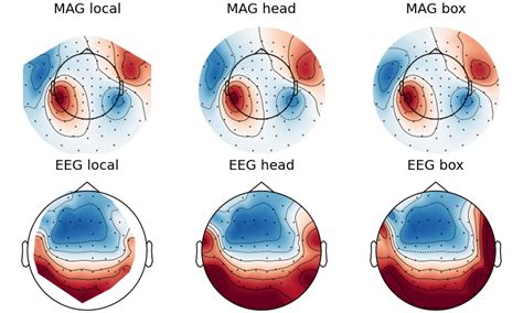 Plotting Topographic Maps Of Evoked Data — Mne 1101 Documentation