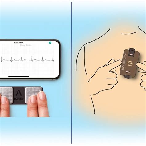 Ecg Mobile Applications Left—fingertip Recordings Right—card Pressed Download Scientific