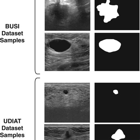 Cr‐ssl Workflow Diagram Consisting Of A Cr‐ssl Training Phase And B Download Scientific