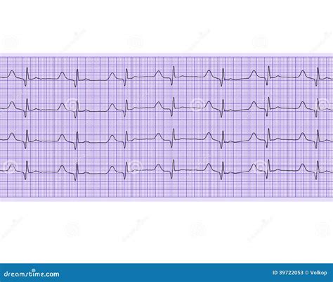 Heart Analysis Electrocardiogram Graph Stock Image Image Of Test Evaluation 39722053