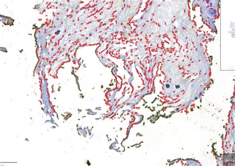 Qupath Analysis Positivecell Error Image Analysis Image Sc Forum