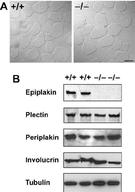 Transmission Electron Microscopy Of Wild Type Skin A C E G And I