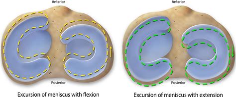 Meniscus Diagram