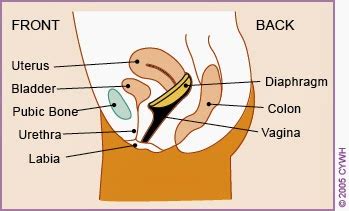 Natural Birth Control Why I Use A Diaphragm Overthrow Martha