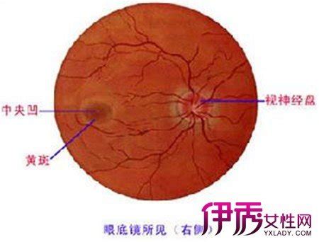 視神經炎病因有哪些 告訴你有3大病因 壹讀