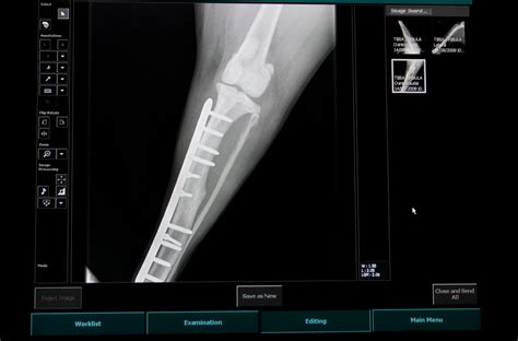 Sie Suchen Einen Dicom Viewer Für Windows Lesen Sie Diese Tipps Und Optionen Postdicom