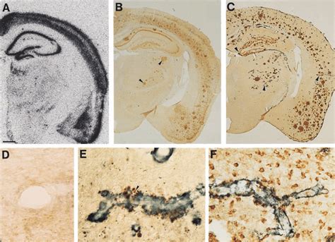 Regional And Neuron Specific Expression Of Human App In App23 Mice A