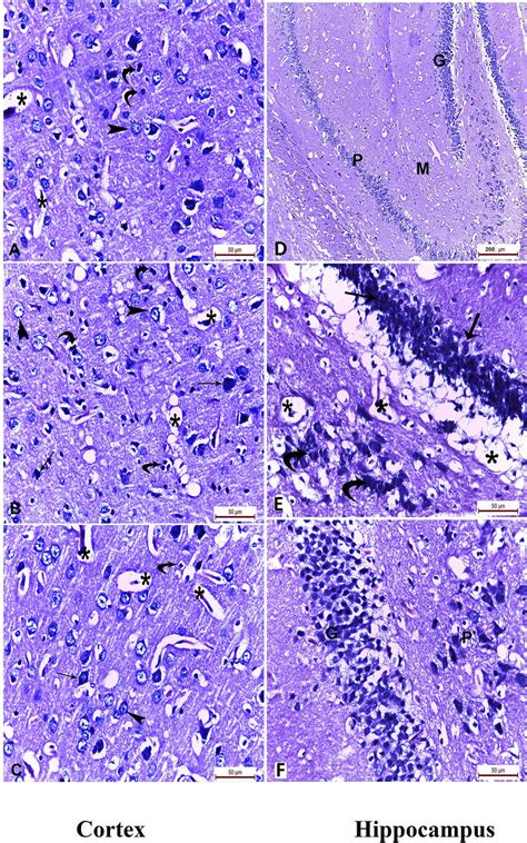 Photomicrographs Of Sections In The Rat Cerebral Cortex 1 And Download Scientific Diagram
