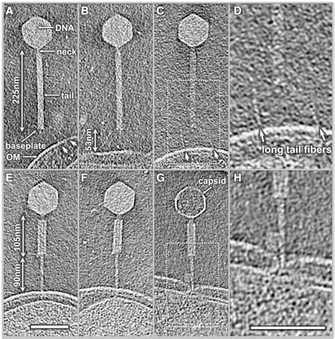 Bacteriophage Electron Micrograph