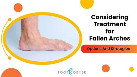 Fallen Arches Considering Treatment Options And Strategies