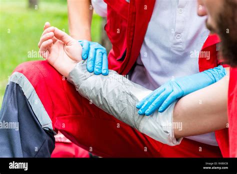 Medical Worker Treating Burns On Man S Arm Stock Photo Alamy