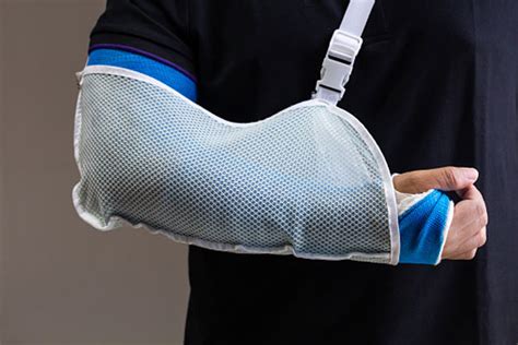 Best Doctor And Treatment For Elbow Dislocation Dr Satish Ortho