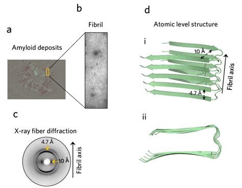 1 Structural Features Of Amyloid A A Micrograph Showing Amyloid B Download Scientific Diagram