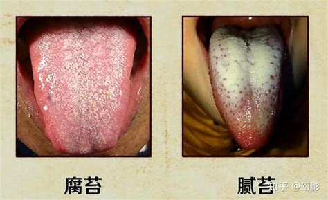 诊断之望诊 知乎