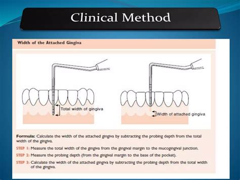 Macroscopic Features Of Gingiva Pptx