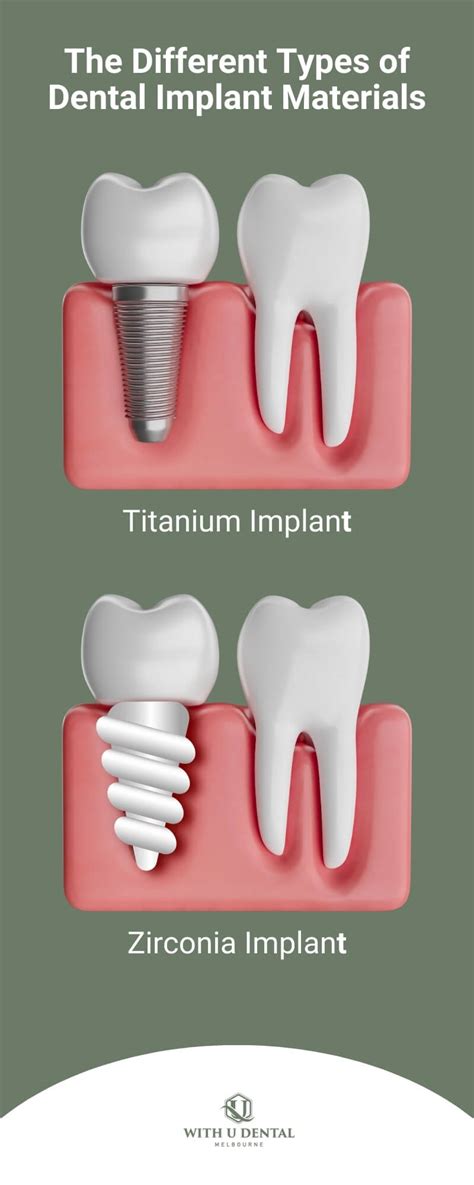 Types Of Dental Implants