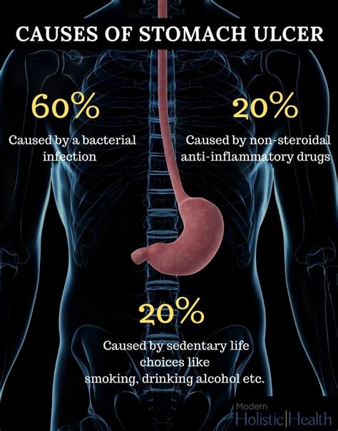 Peptic Ulcer Symptoms