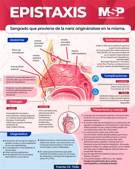 Epistaxis