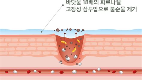 상처와 파르나겔