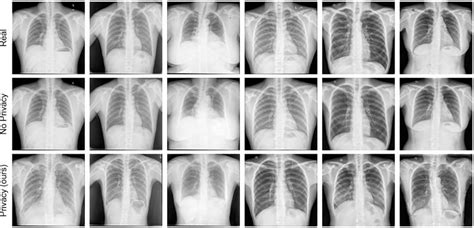 Aiedge Ai Aihealth Hpc Highperformancecomputing Federatedlearning