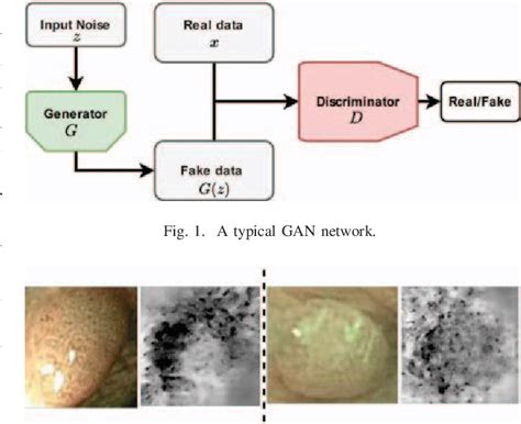 Figure 1 From Improved Endoscopic Polyp Classification Using Gan Generated Synthetic Data