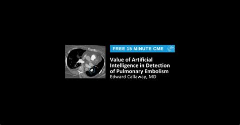 Value Of Artificial Intelligence In Detection Of Pulmonary Embolism