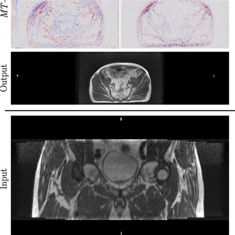 Example Corrections Using The Model Pelvis Download Scientific Diagram