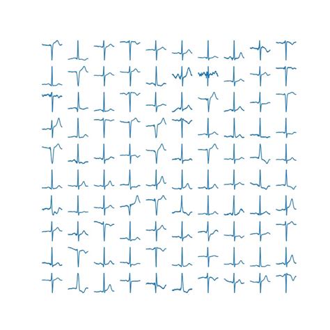 Electrocardiogram Generation And Feature Extraction Using A Variational Autoencoder Deepai
