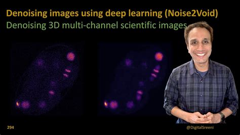 294 Denoising 3D Multi Channel Scientific Images Using Noise2Void