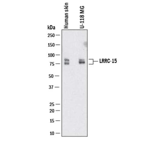 Human Lrrc15 Antibody R D Systems 25 μg Unconjugatedantibodies