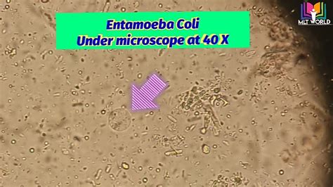 Escherichia Coli Microscope