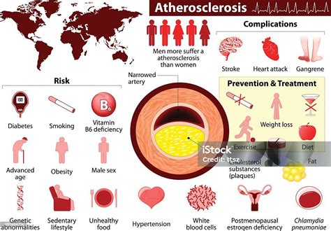 Aterosklerosis Ilustrasi Stok Unduh Gambar Sekarang Aterosklerosis Dna Darah Istock
