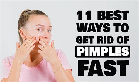 Best 11 Ways To Get Rid Of Pimples Fast NeoStopZone
