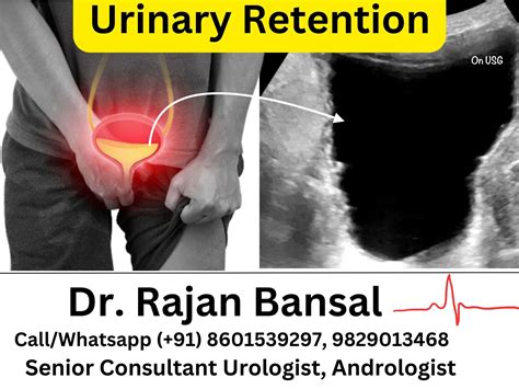 Urinary Retention Urinary Retention Protocol Classic Creately