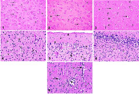Photomicrographs Of Cerebral Cortex Sections Of Adult Male Mice In Download Scientific Diagram