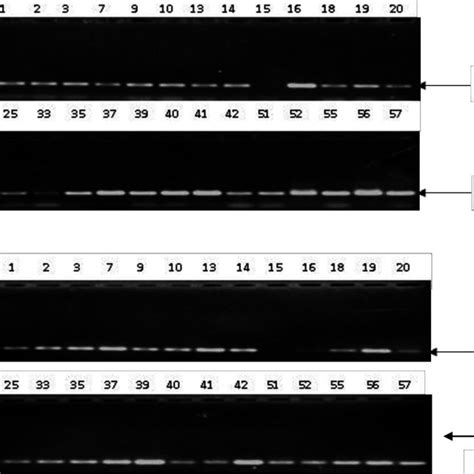 A Pcr Analysis Of The Putatively Transformed Banana Plants Amplifying