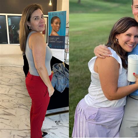 Weight Loss Injections Tirzepatide At Dorothy Leasure Blog